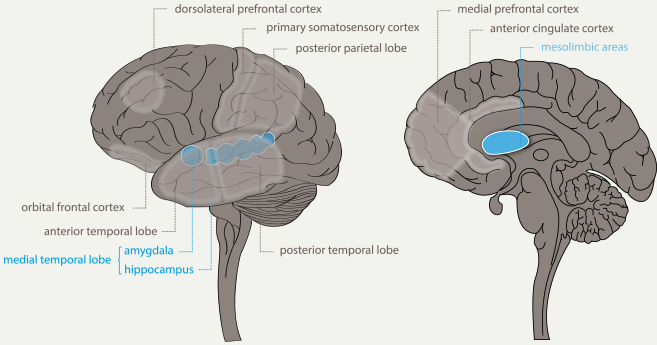 Play Experiences for People with Alzheimer’s Disease